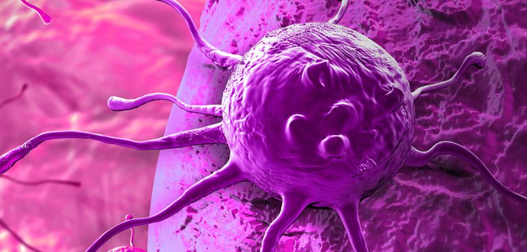 Caris Life Sciences Launches AI-Driven Profiling Tool for Tumors ...