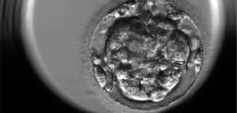 New Technology Enables Real-Time Embryo Monitoring » Dallas Innovates